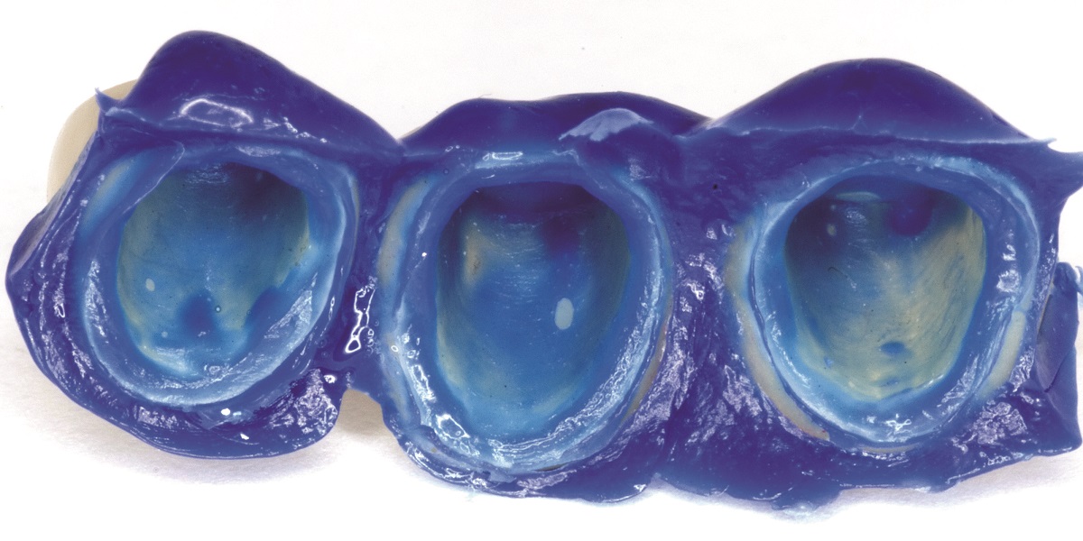 FIT CHECKER BLUE CARTUCCE 48 ml cad.